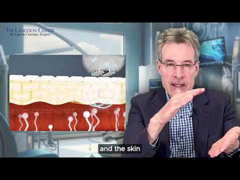 The SCIENCE of TriLift - Non Surgical Facelifts With Muscle Stimulation And RF Microneedling