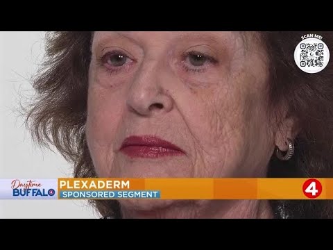 Daytime Buffalo: Plexaderm | Sponsored Segment