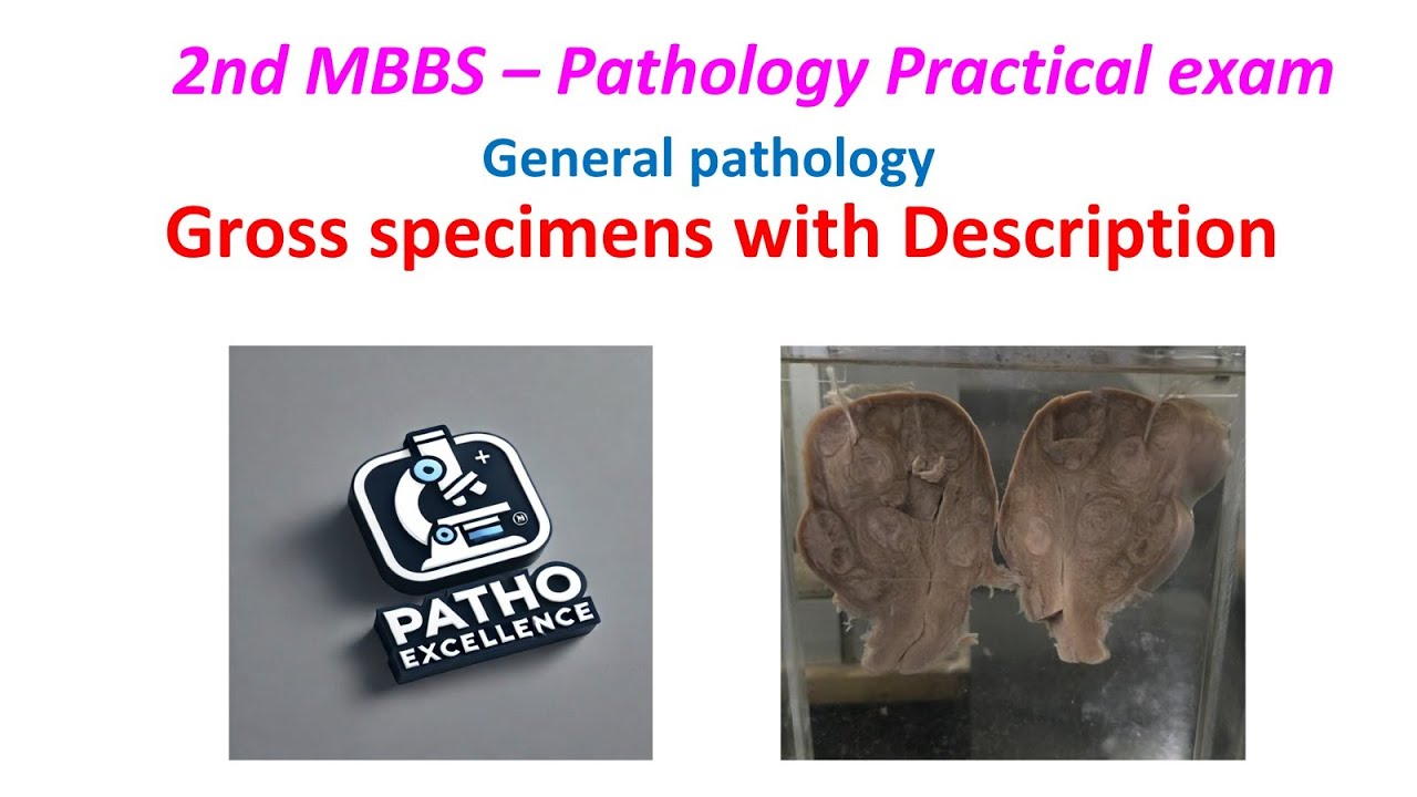 2nd MBBS Pathology Practical | General Pathology Gross Specimens with Description  Viva & Exam Guide