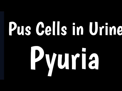 Pus Cells in Urine | What Is Pus Cell & Pyuria | Causes, Symptoms, Normal Range Pus Cells In Urine