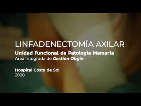 axillary lymphadenectomy Hospital Costa de Sol