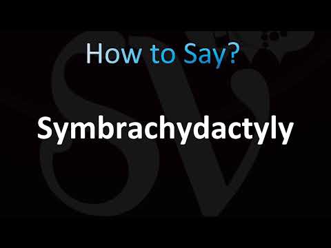 How to Pronounce Symbrachydactyly (CORRECTLY!)
