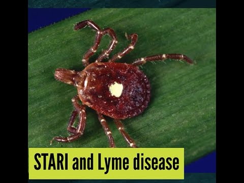 STARI & Lyme Disease | Madison Area Lyme Support Group