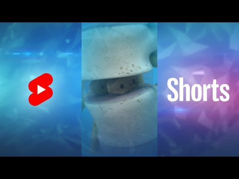 What is Posterior Lumbar Interbody Fusion? | PLIF #Shorts