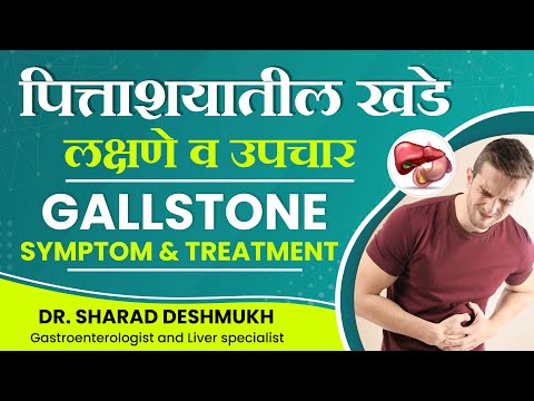 पित्ताशयातील खडे लक्षणे व उपचार - Gallstone Symptoms and Treatment - Dr. Sharad Deshmukh