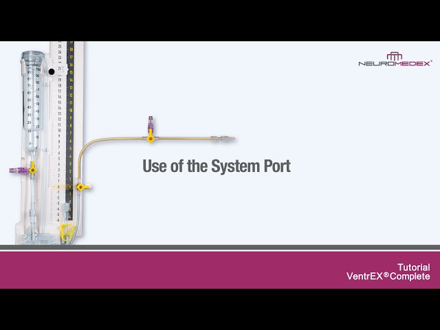 VentrEX® Complete EVD | Ventrex