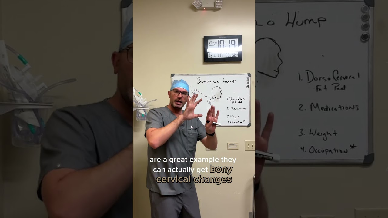 Buffalo Hump Lipo: Say Goodbye to That Hump! | Dr. Nykiel