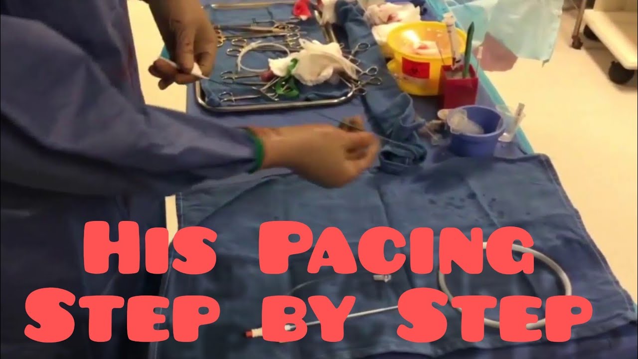 #His #bundle #pacing and checking  #physiological #Pacemaker #programming #DotheHis