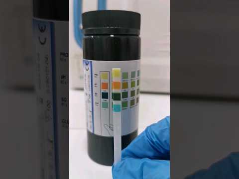 Urinalysis - Urine analysis It's normal #laboratory #mls #cls #medtechstudent #microscope #urine #mt