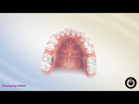 Cetlin Mechanics | Dental Braces | Temecula Valley, CA
