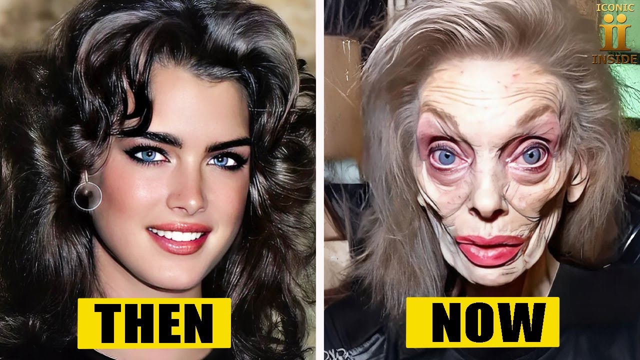 20 Celebrities Who Have Aged Horribly That Unrecognizable Then and now 2025