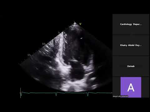 Echo Conference (Aortic Regurgitation)