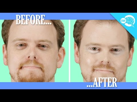 Why Do We Get Bags Under Our Eyes?