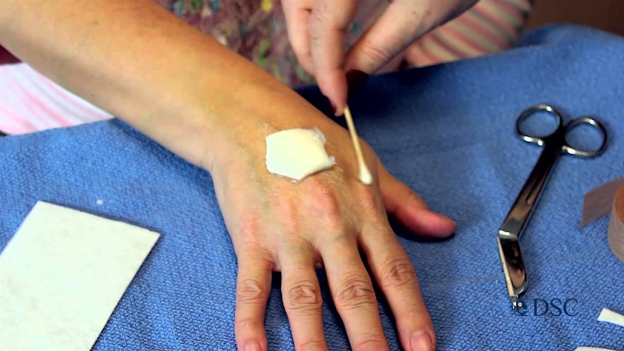 Post Op Instructions for a SKIN Graft at DSC