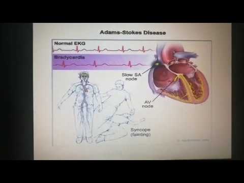 Dr Abdul Basit| 1st year MBBS| (Physiology) | CARDIAC ARRHYTHMIAS-III