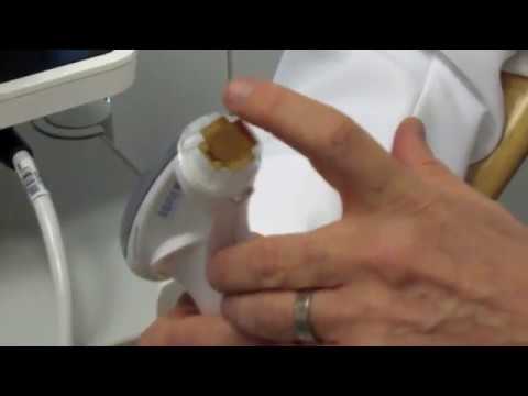 eMatrix Non-Laser Skin Resurfacing - Introduction (1 of 2) - Dr. Nissan Pilest (Irvine, CA)