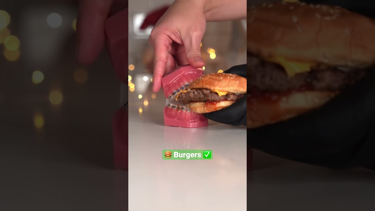 Braces vs Food - Five Guys Edition w/ The Braces Doc