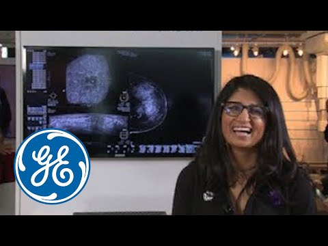 RSNA 2017 – Value of Automated Breast Ultrasound (ABUS) | GE Healthcare
