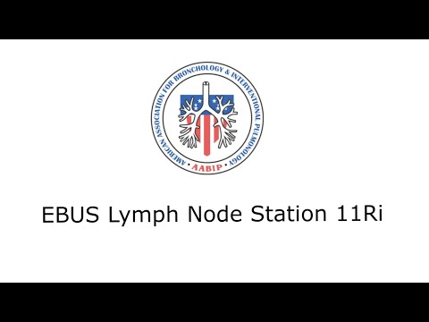 EBUS Lymph Node Station 11R(i)