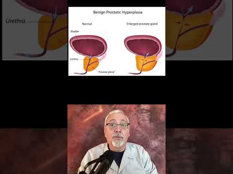 What is the Prostate Gland?