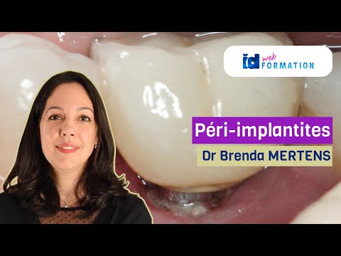 Formation E-learning DPC : Les péri-implantites