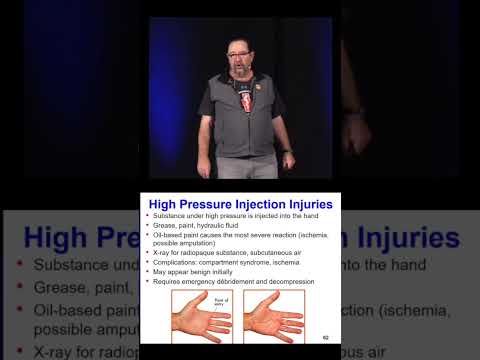 High Pressure Injection Injuries Are Worse Than They Look 💦 #shorts