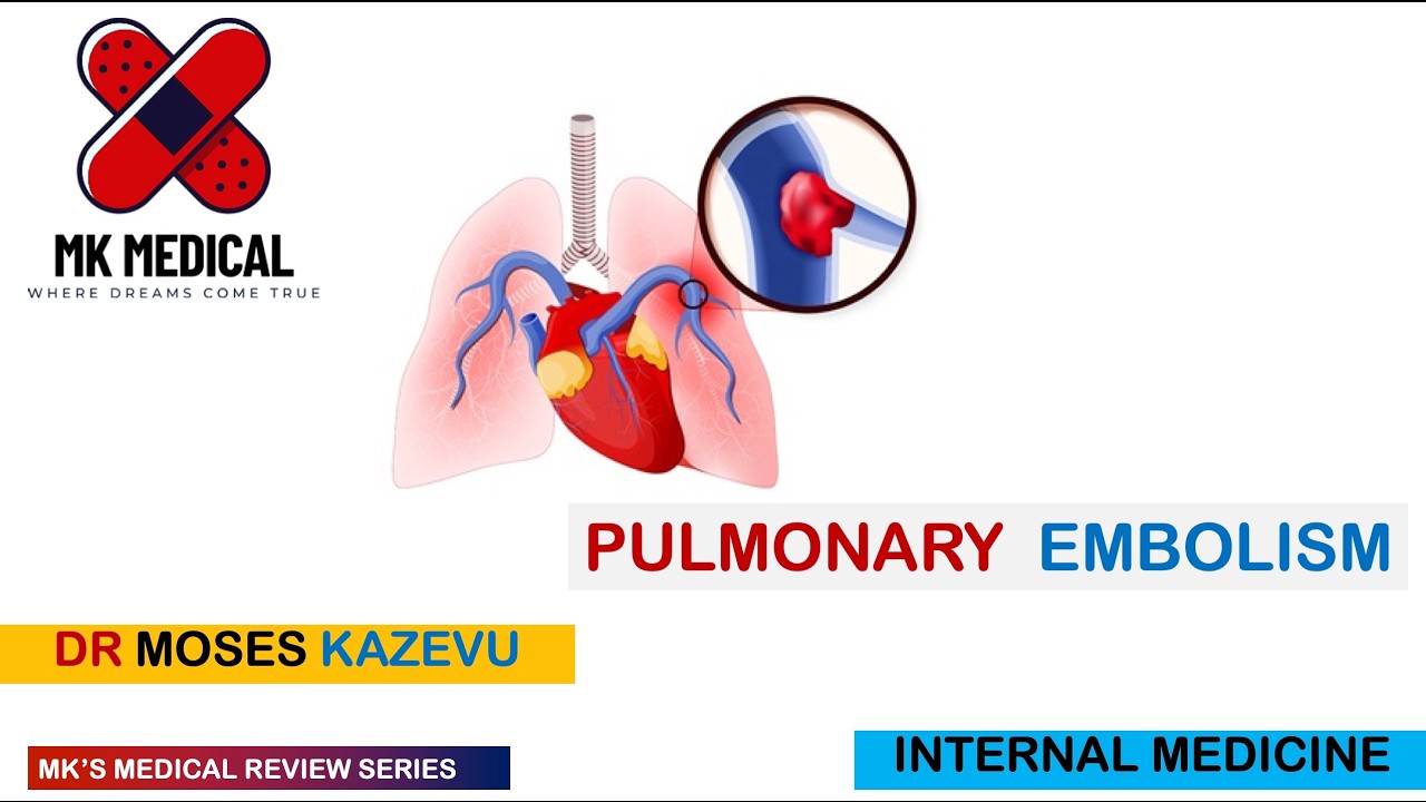 Pulmonary Embolism