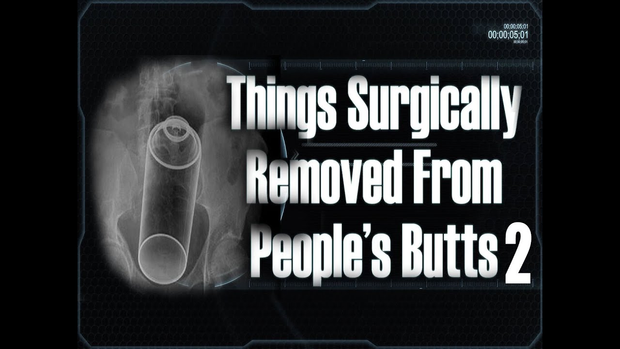 Things Surgically Removed Peoples Butts 2