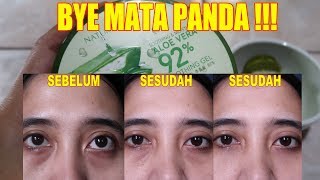 matafuzziblog: Fungsi Bintik Kuning Pada Mata