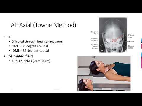 Radiographic Positioning of the Skull