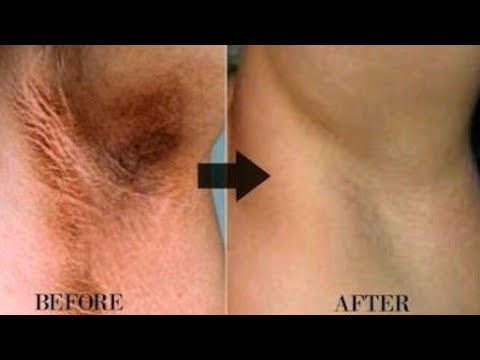 whitening formula || Fuller earth/ mutani mitti scrub bar || in urdu
