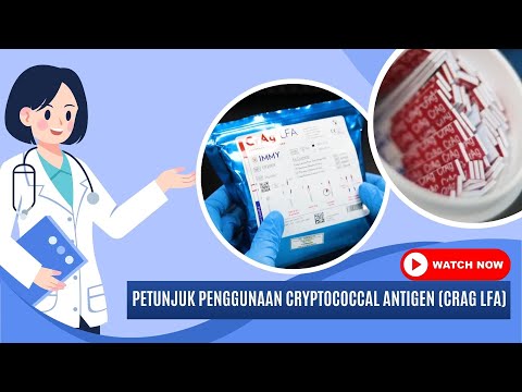 Video Tutorial Penggunaan Cryptococcal Antigen (CrAg LFA)