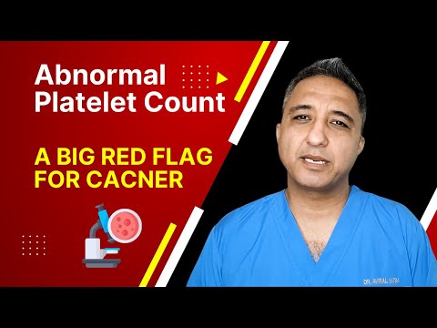 Abnormal Platelet count - A Big Red Flag For Cancer - NICE Guidelines