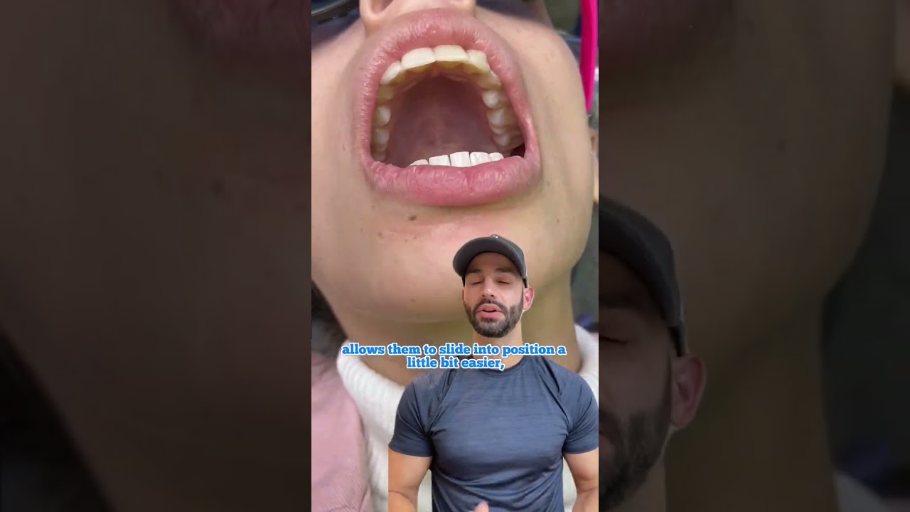 Invisalign and IPR to help straighten teeth, reduce overbites and alter tooth shape.