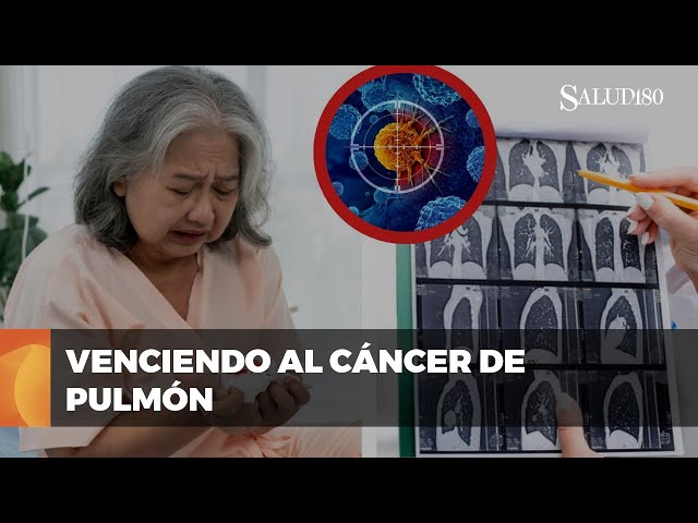 Hombre pensó que tenía dolor por gases pero era colapso pulmonar