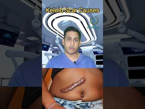 கீலாய்டு தலும்புகள் ஏற்பட காரணம் |வளர்வடு | Keloid scar causes | Keloid scar treatment| வடுவேற்றம்