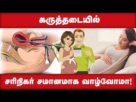 கருத்தடையில் சரிநிகர் சமானமாக வாழ்வோமா! | Non scalpel vasectomy | Dinamalar Exclusive