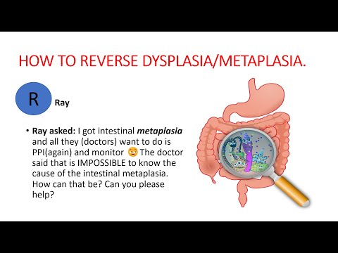 Metaplasia, dysplasia. How to reverse dysplasia/ metaplasia. Natural treatment.