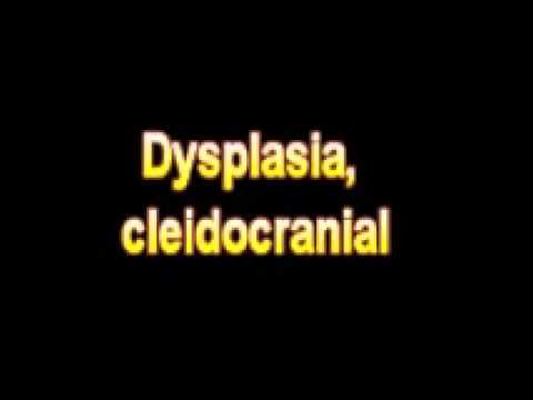 What Is The Definition Of Dysplasia, cleidocranial - Medical Dictionary Free Online