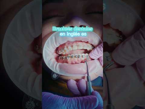 BRACKETS DENTALES EN INGLÉS | Interpretación Consecutiva Medica