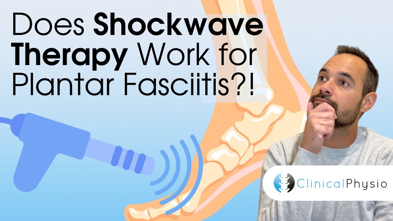 Exploring the Efficacy of Shockwave Therapy for Treating Plantar ...