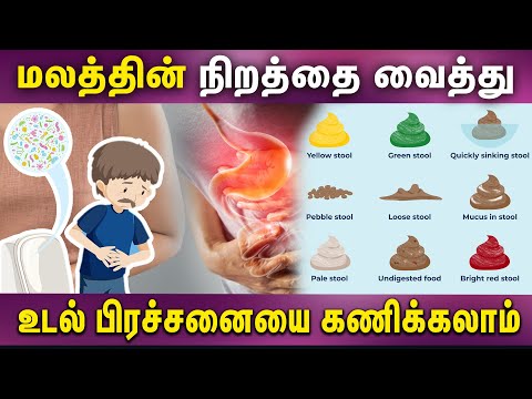 Motion colour Defined in Tamil | உடல்நிலை பற்றி உங்கள் மலத்தின் நிறம் என்ன கூறுகிறது?