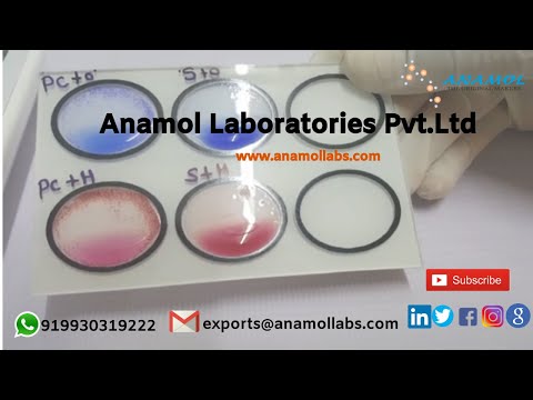 Typhoid Test Kit - Widal Test Kit Latest Price, Manufacturers & Suppliers