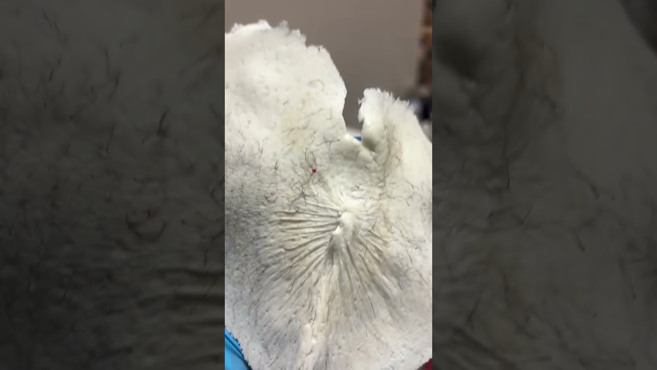 Butt hole wax ￼
