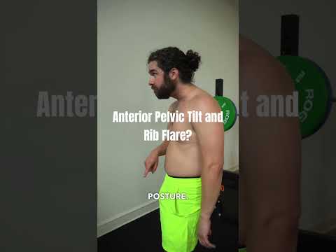 How Not to Fix Rib Flare!