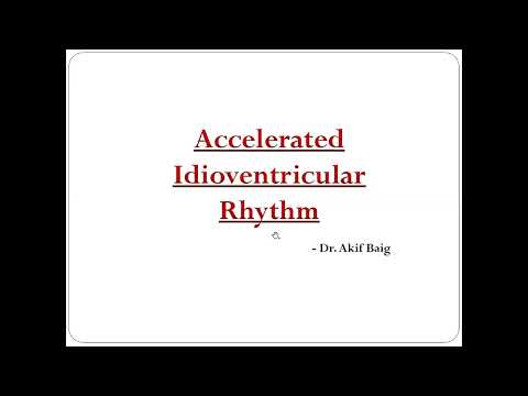 Accelerated Idioventricular Rhythm (AIVR): Dr. Akif Baig