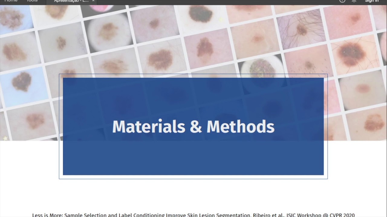 Less is More: Sample Selection and Label Conditioning Improve Skin Lesion Segmentation