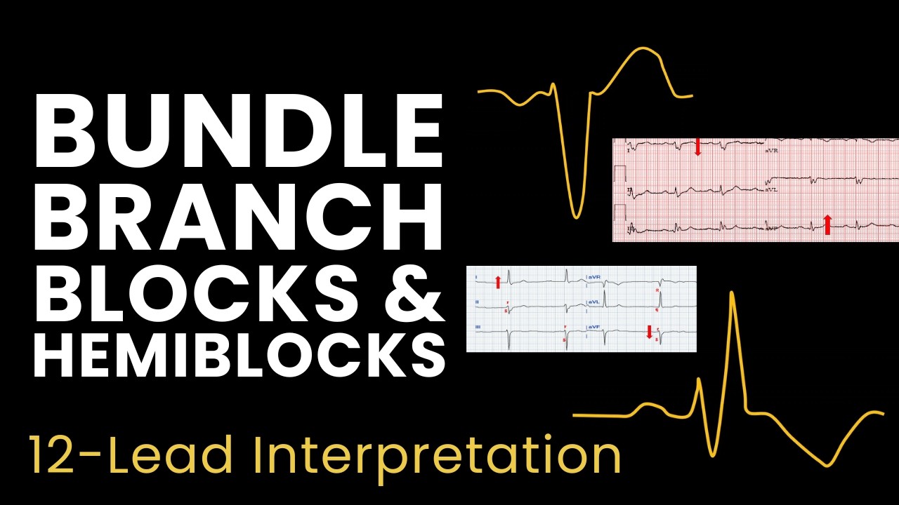 Bundle Branch Blocks (LBBB & RBBB) & Hemiblocks (LAFB & LPFB) Explained