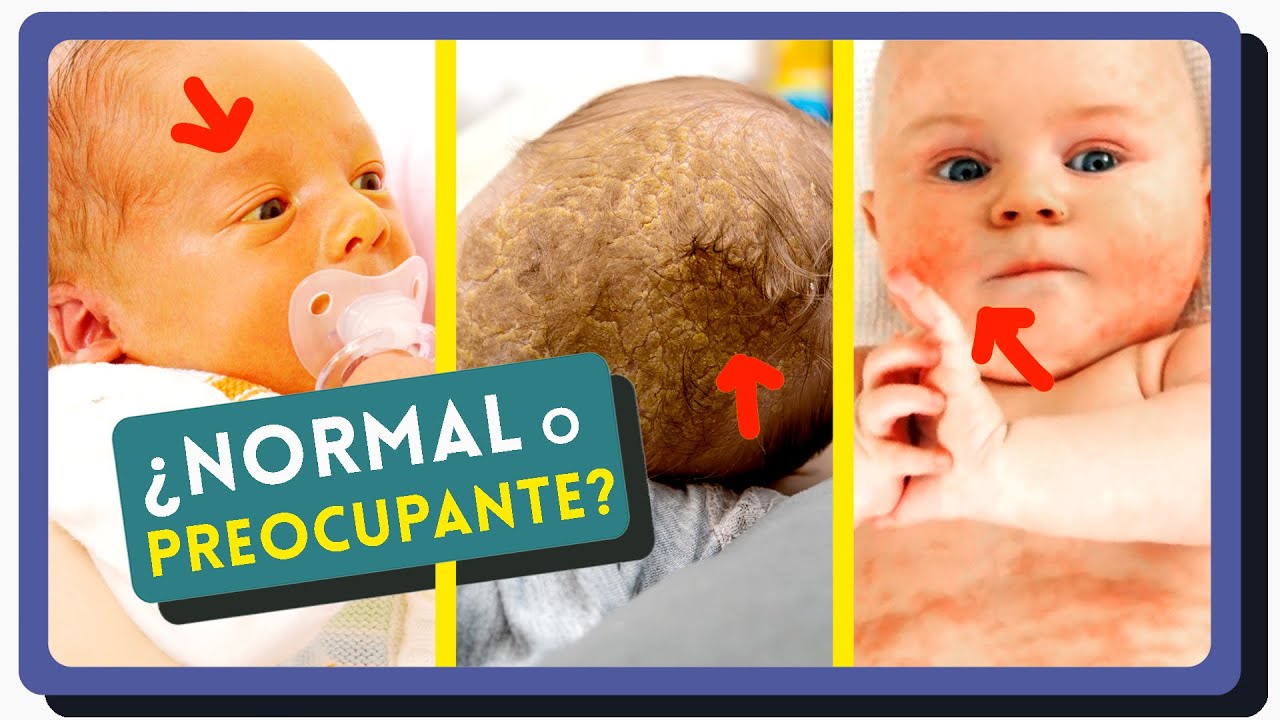 EVERYTHING YOU NEED TO KNOW ABOUT BABY SKIN: Jaundice, Sun Protection, Newborns, Atopy...