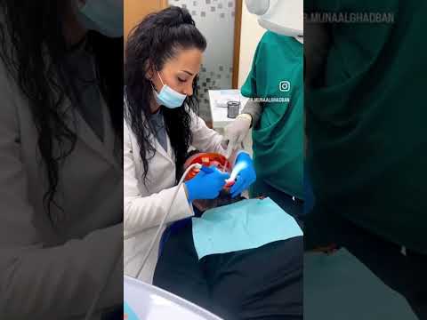 #veneers #dentist #dental #dentalcare #dentalclinic #sharjah